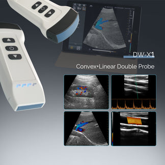 Handheld Wireless Phone Ultrasound Probe Color Doppler Ultrasound Mach ...