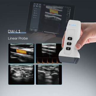 Handheld Wireless Phone Ultrasound Probe Color Doppler Ultrasound Mach ...