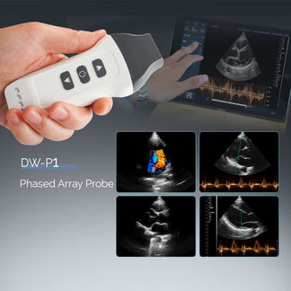 Handheld Wireless Phone Ultrasound Probe Color Doppler Ultrasound Mach ...