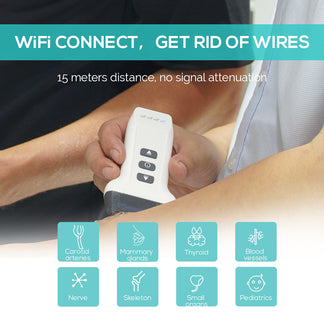 Handheld Wireless Phone Ultrasound Probe Color Doppler Ultrasound Mach ...
