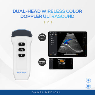 Handheld Wireless Phone Ultrasound Probe Color Doppler Ultrasound Mach ...